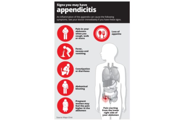 It’s time to remind ourselves about appendicitis | The Star Online