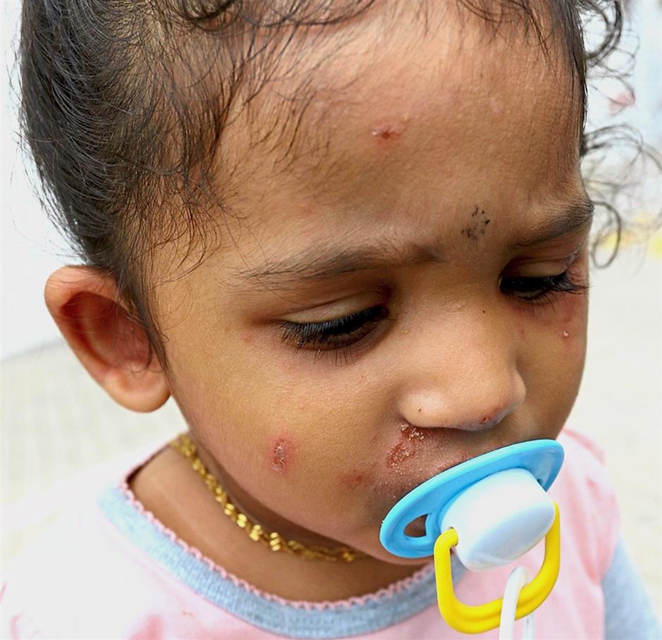 Charlie Ants keep returning to condo | The Star